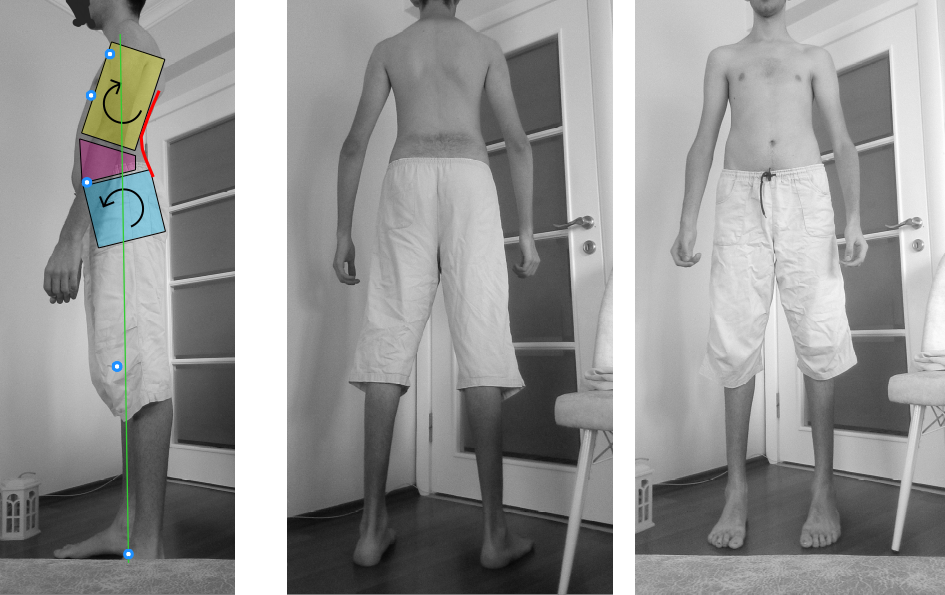 Posture assessment: confidential 04 | Good Posture Studio Posture assessment: confidential 04 | Good Posture Studio